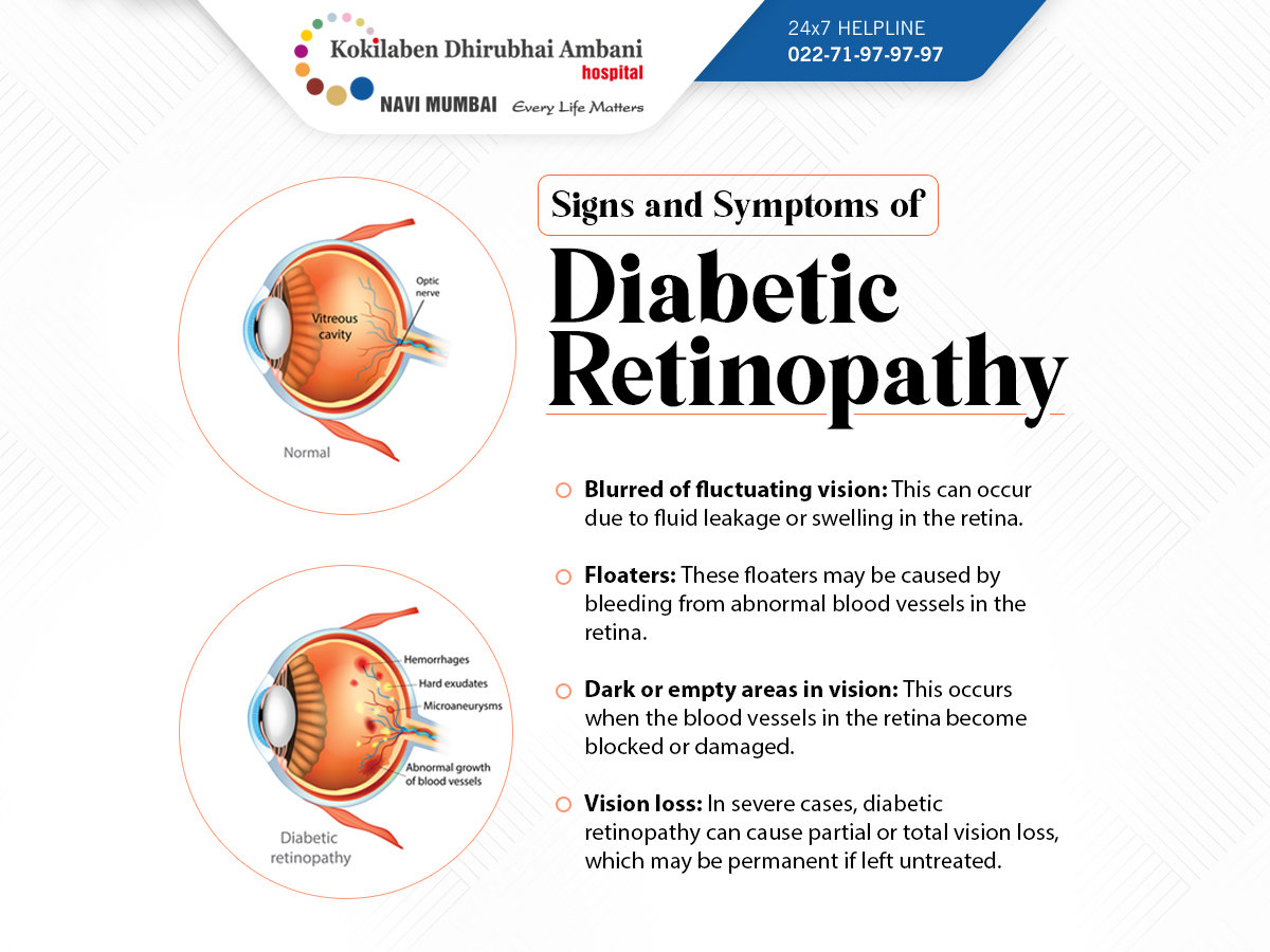 Signs And Symptoms Of Diabetic Retinopathy